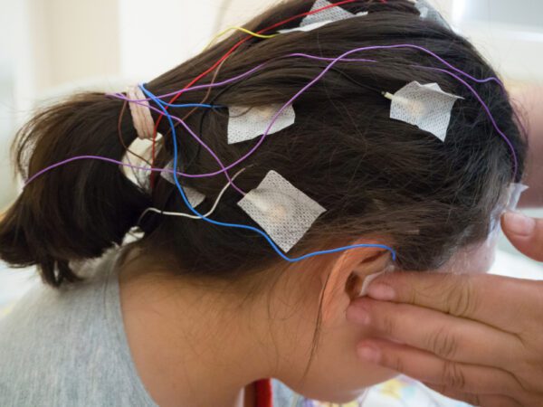 All About EEG Tests: Procedure, Results & Cost