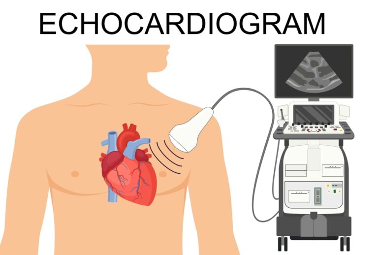 Types of Echocardiography for Heart Health Screening