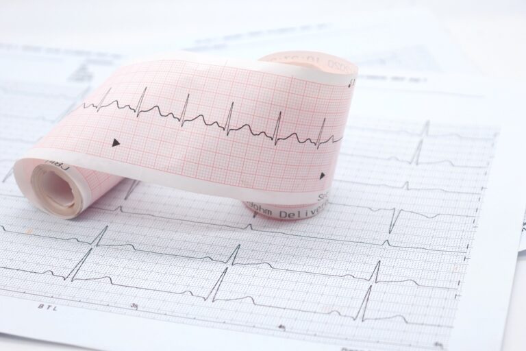 What to Expect During an ECG Test