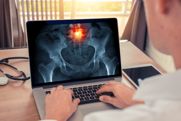 Understanding the Risks and Side Effects of CT Scans